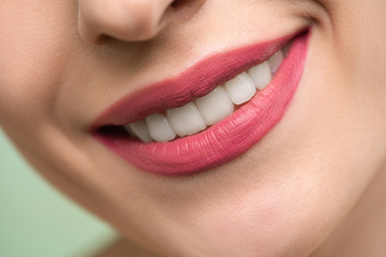 The Royal smile and how to get it | Mulgrave Dental Centre | Surrey